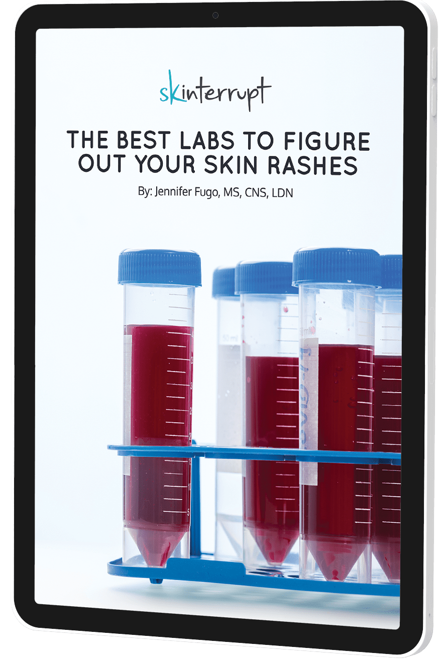 Skin Rash Deep Dive – Quell Shop